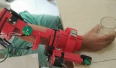 Scientists Develop Improved Algorithm for Upper Arm Rehabilitation ...